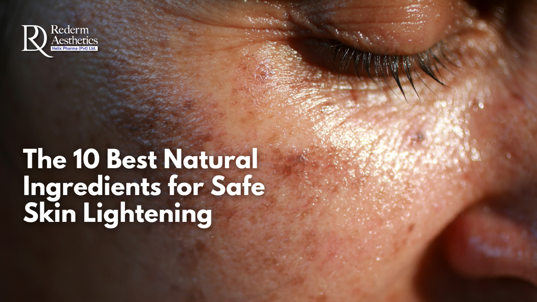 The 10 Best Natural Ingredients for Safe Skin Lightening – Redermaesthetics